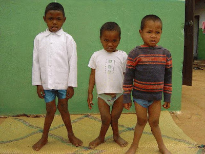 LA NUEVA CARAVANA: RAQUITISMO