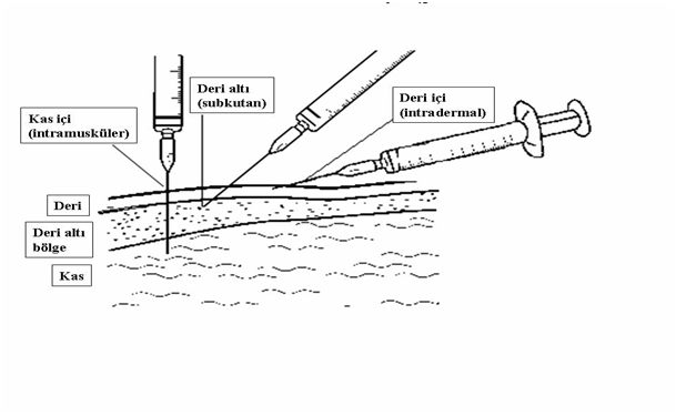 INTRAMUSKULER ENJEKSİYON UYGULAMASI: 2016
