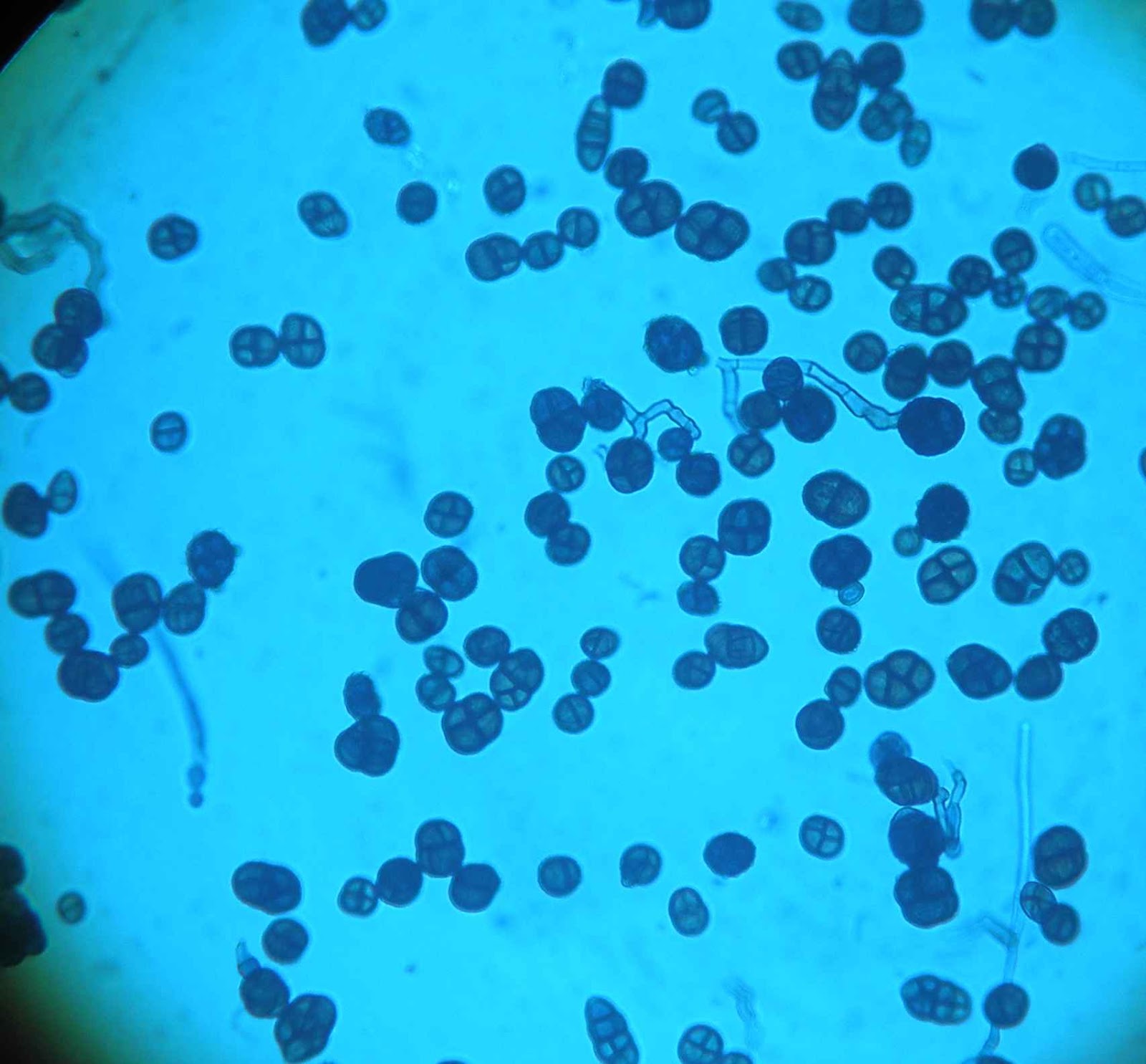 ATLAS MICOLOGIA: STEMPHYLIUM