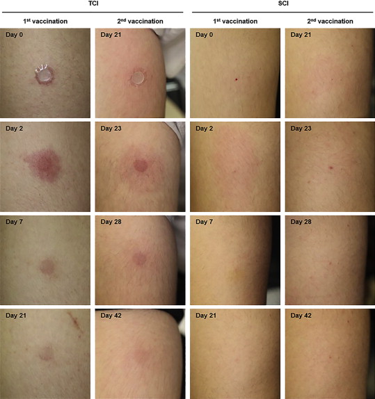 This Biotech Discovery Means You’ll Never Need a Painful Flu Shot Again ...