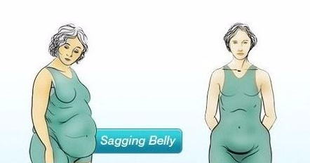 4 DIFFERENT TYPES OF BELLY FAT: FIND YOURS AND LEARN HOW TO GET RID OF ...