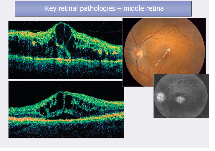 Vision Care Specialists
