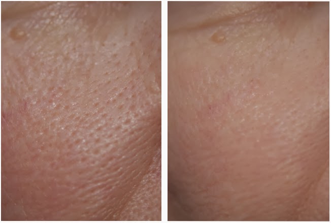 Stay Beautyful: Benefit The Porefessional