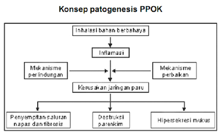 PENYAKIT PARU OBSTRUKTIF KRONIK (PPOK) : Definisi, Gejala, Pengobatan ...