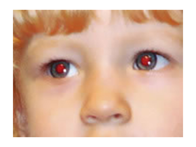 MusicallyCOM: NIÑO CON OJOS ROJOS