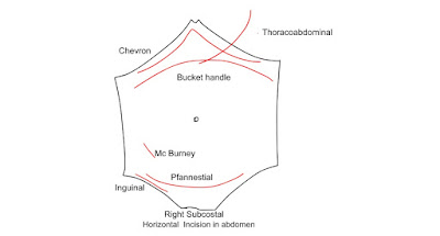 My notes: Its How I graduated Medical School.: Surgical Incision in ...