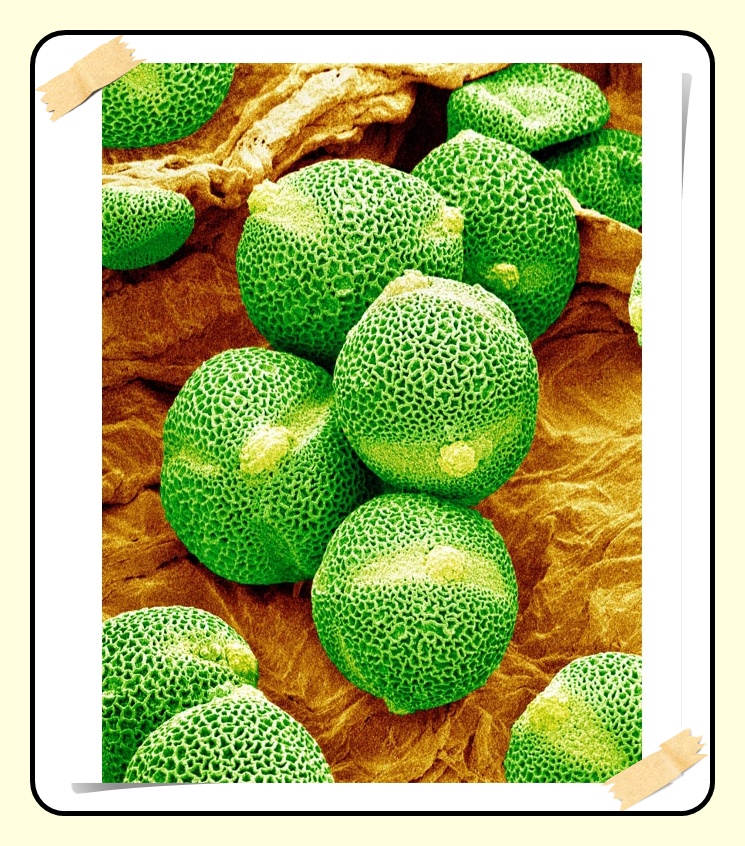 Witty Nity: Pollen Under a Microscope
