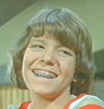 Braces Memories: Braces In the 70s