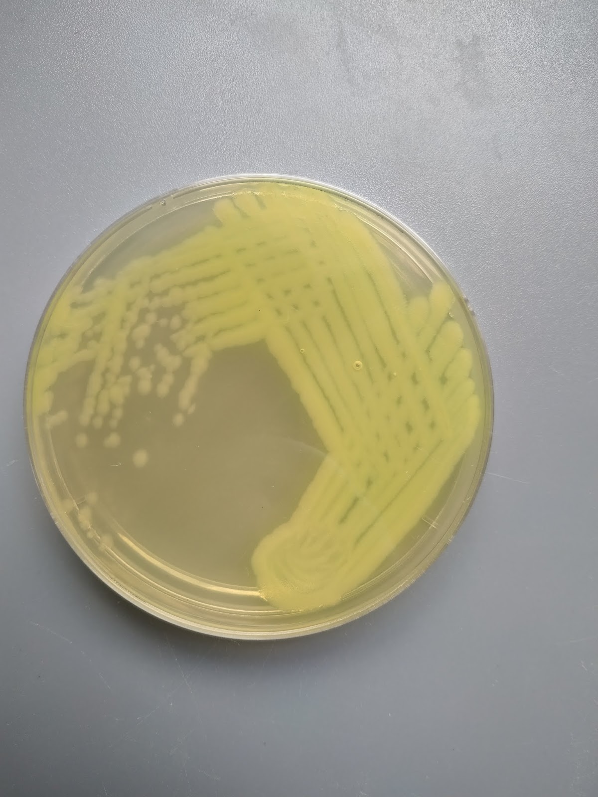 MICROBIOLOGY BLOG FOR STUDENTS (MBLOGSTU): Cultural and Biochemical ...