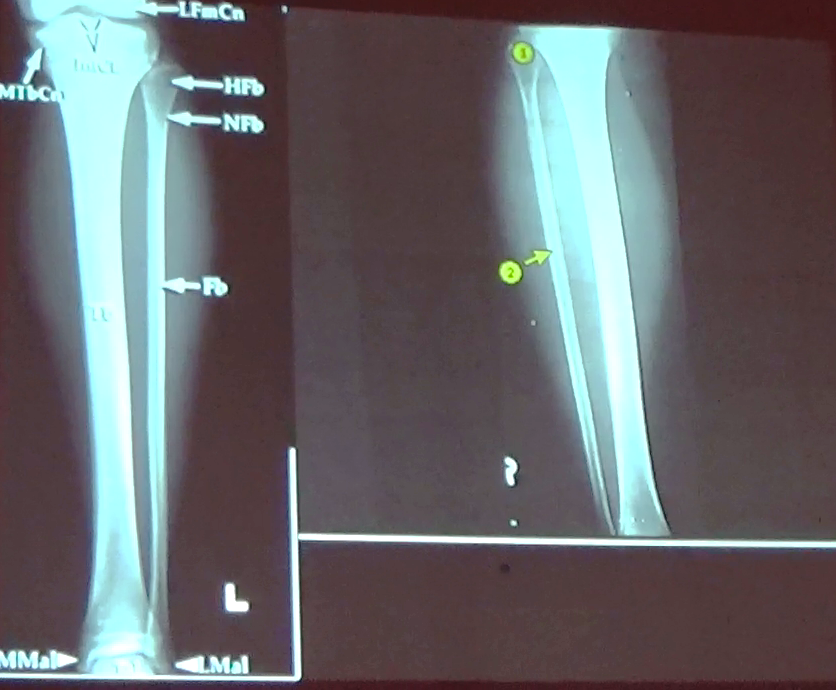RADIOANATOMIA: abril 2015