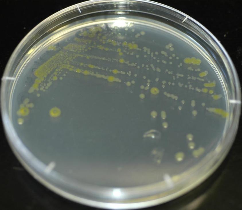 Auger Gear Image: Agar Plate