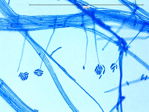 Fun With Microbiology (What's Buggin' You?): Sarocladium kiliense