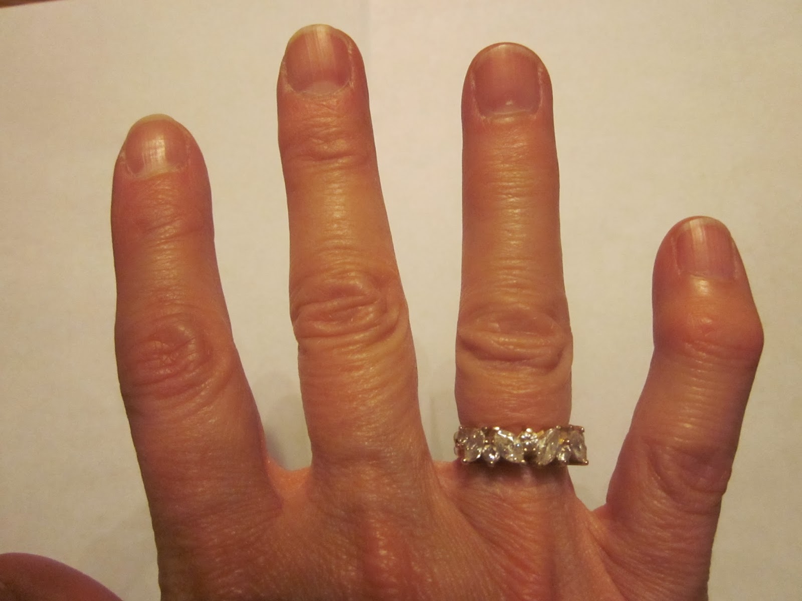 Shuffle, Scrap, Sparkle: Arthritis...A painful way of life