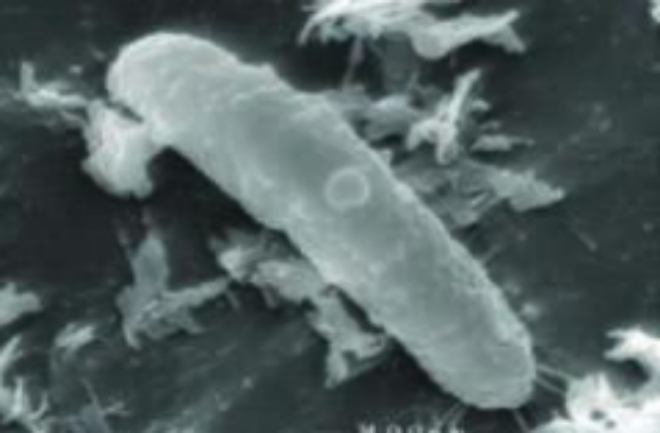 LA BACTERIA QUE COME EL PLÁSTICO: "IDEONELLA SAKAIENSIS"