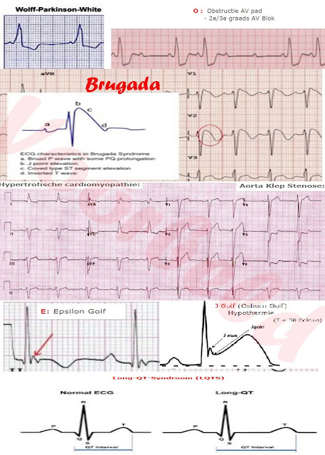 Shop: Acute Zorg Kaartjes: WOBBLER/EKG - Acute Zorg Blog