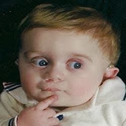 Medical Treatment Pictures-for Better Understanding: CHARGE Syndrome