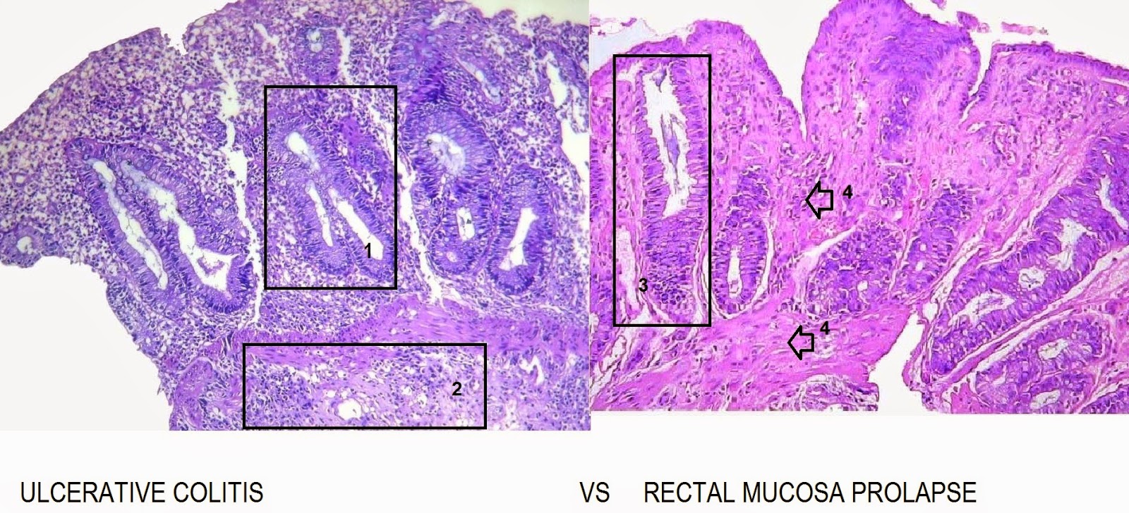 GASTROINTESTINAL AND LIVER HISTOLOGY PATHOLOGY ATLAS: COLON : RECTAL ...