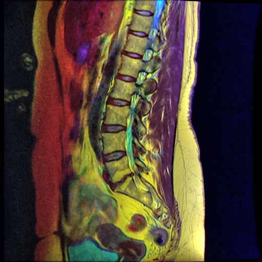 Nevit's blog: Color MRI of the Lumbar vertebrae