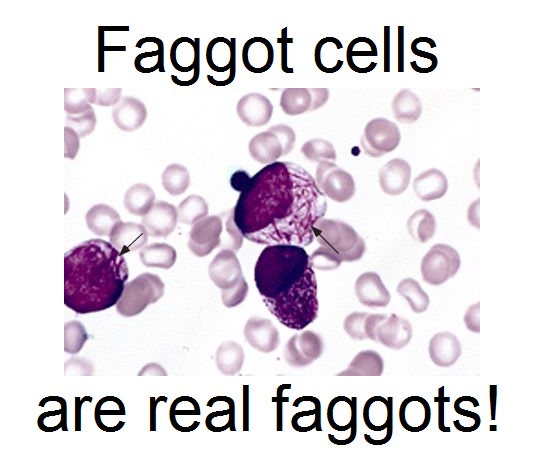 Studium medicíny je kopec srandy!: Faggot cells- interna