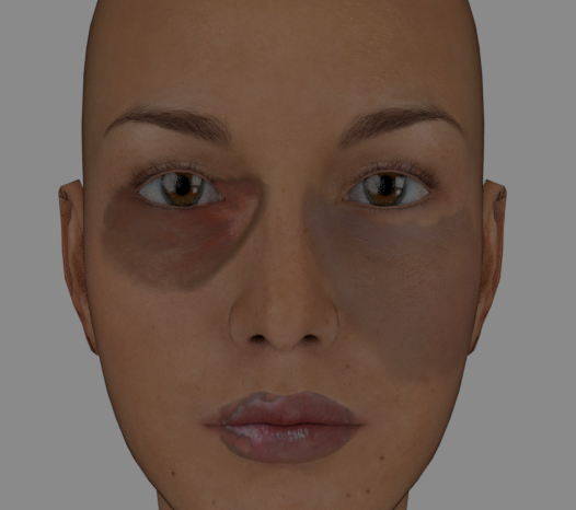 Diffeomorphic: Shells and Layered Images