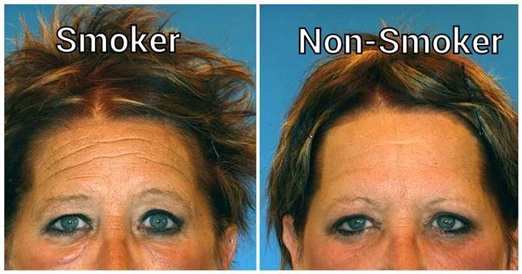 Zamani 84: Perbezaan Wajah Antara Perokok Dan Bukan Perokok