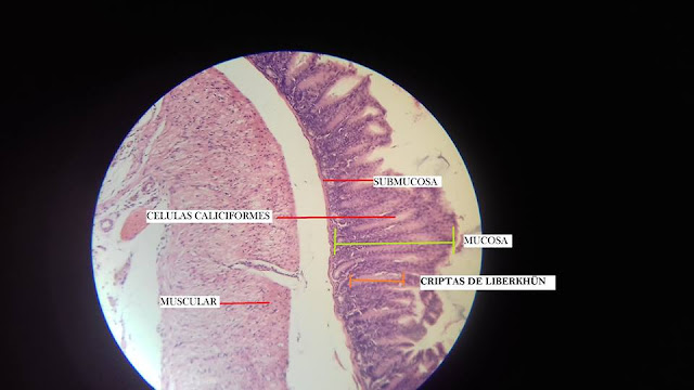 Micrografías Intestino Grueso y Delgado