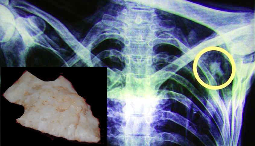 Ashes, ashes, all fall down