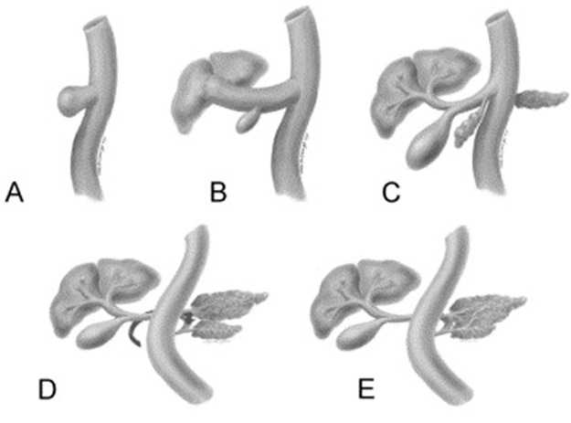 MBBS Medicine (Humanity First): The Gallbladder and bile ducts