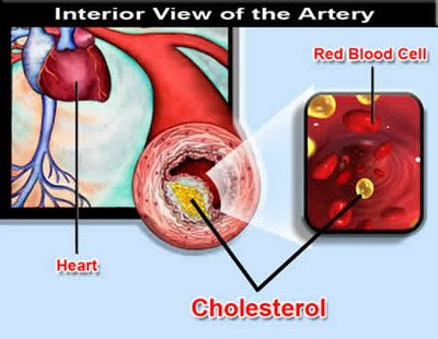 MIRACULUM MUNDI: CHOLESTEROL 2