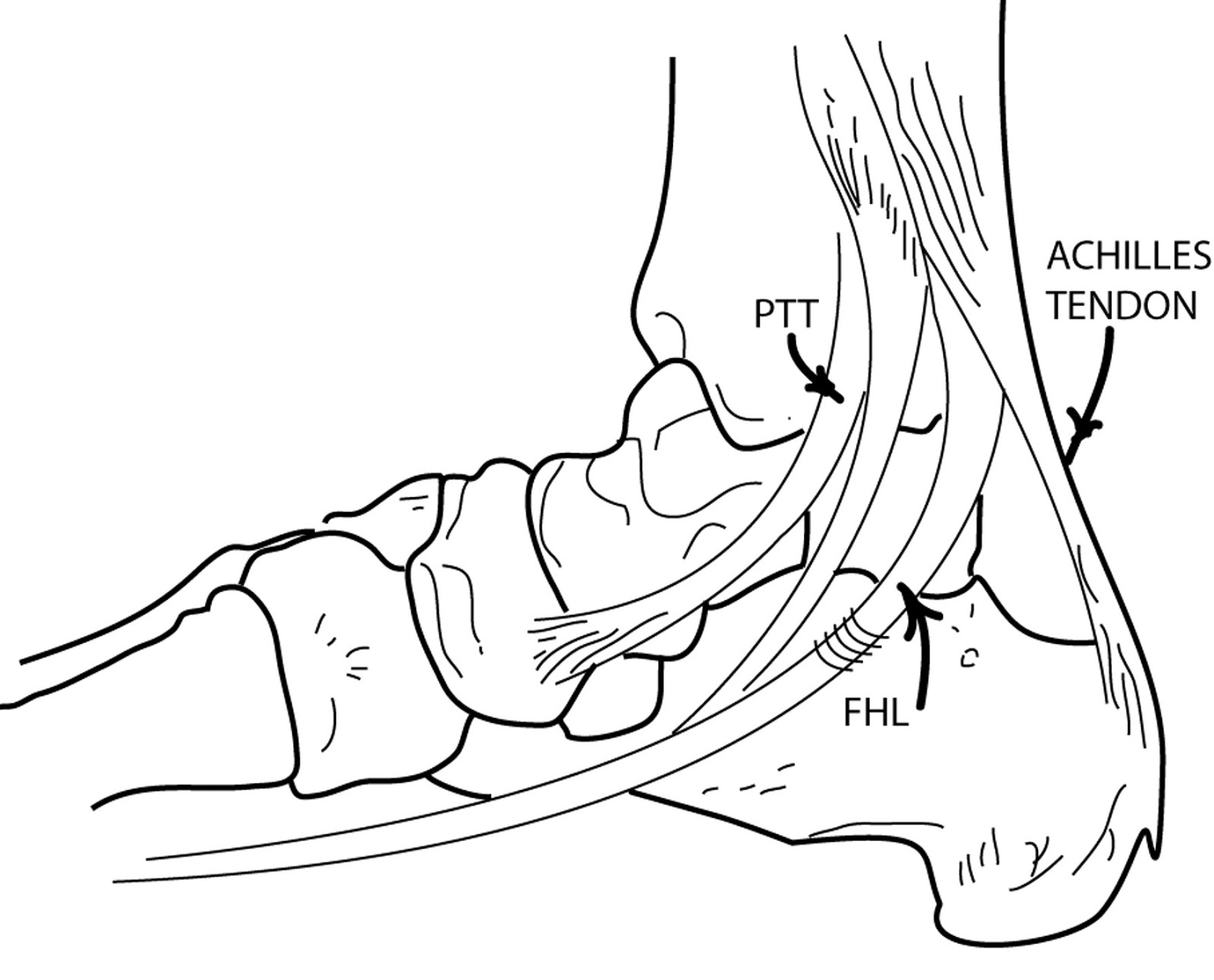 jillgoes: Countdown To Surgery