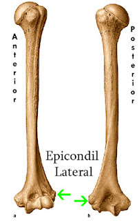 FISIOTERAPIA a domicilio: Epicondilitis lateral o codo de tenista