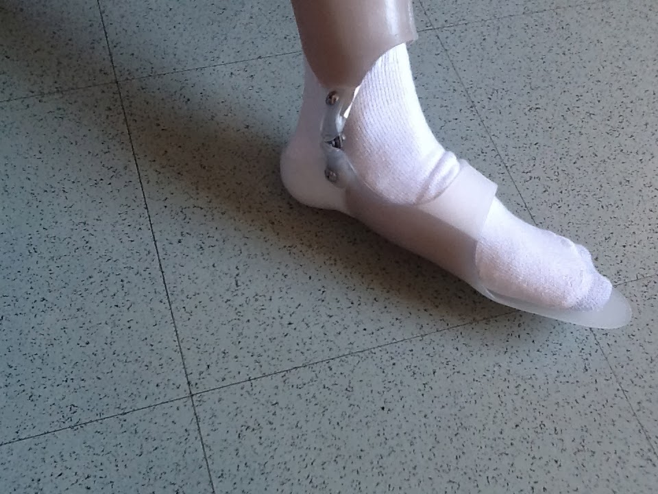 Foot and Ankle Problems By Dr. Richard Blake: Monday's Images of the ...