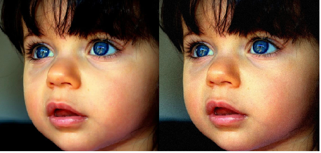 Neve Visual: Sintomas da Neve Visual