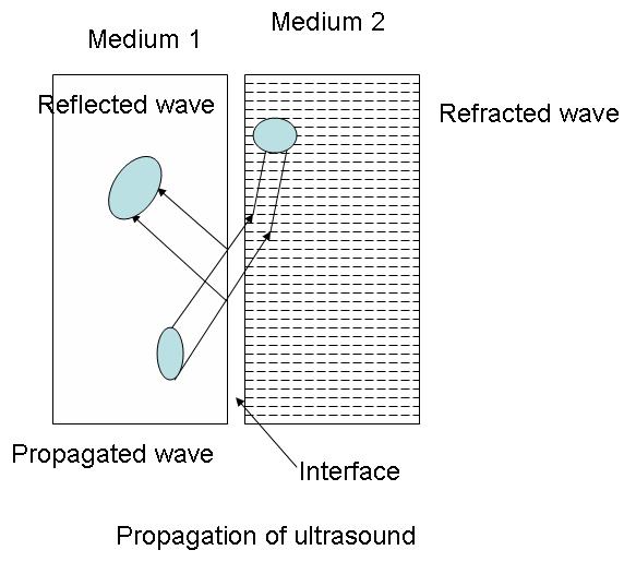 Instrumentation and Control Engineering: Ultrasonics – Introduction.