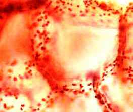 Leucoplast Structure