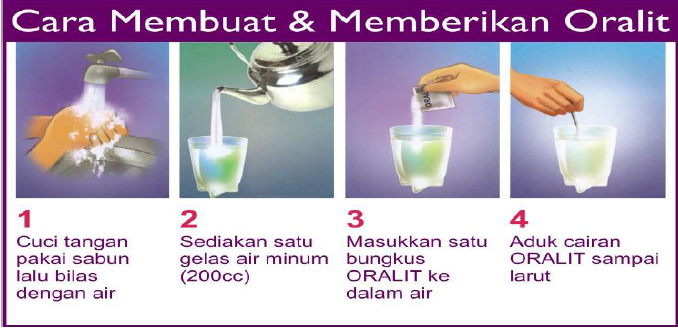PUSKESMAS CIBIRU HILIR: Layanan Rehidrasi Oral Aktif (LROA)