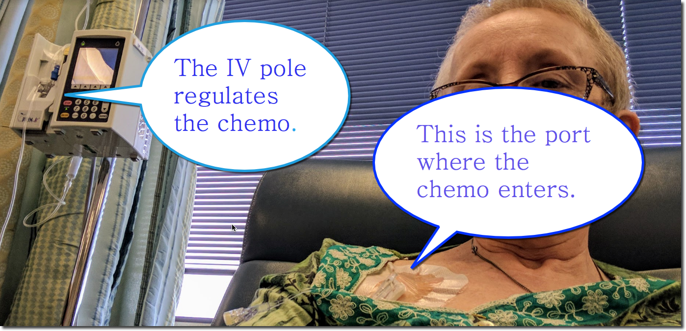 My Stage IV Cancer Experience: Perfuse Infusions