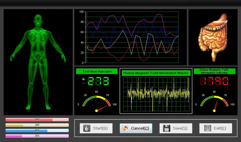 HERBAL GREENWORLD: PRODUK QUANTUM RESONANCE MAGNETIC