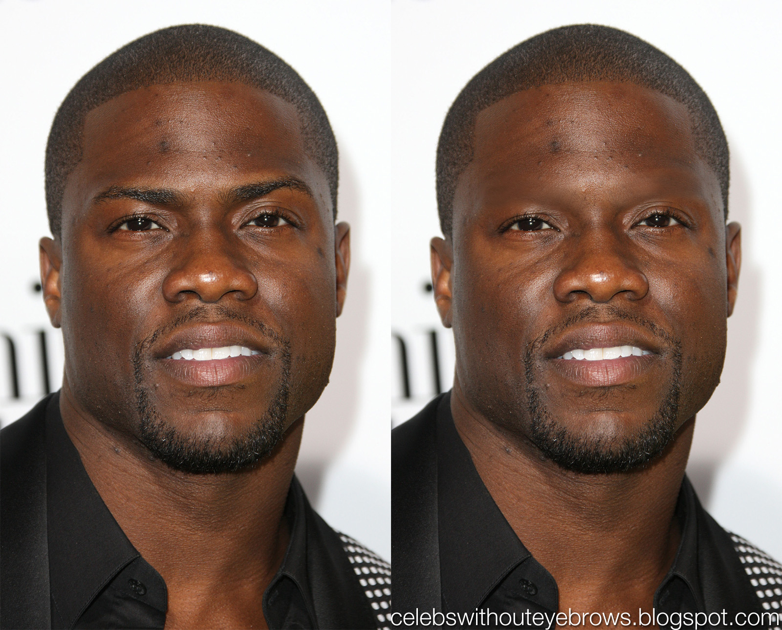 Celebs Without Eyebrows: Kevin Hart