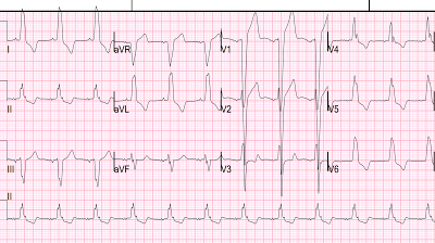 Medical Laboratory and Biomedical Science: Dr. Smith's ECG Blog