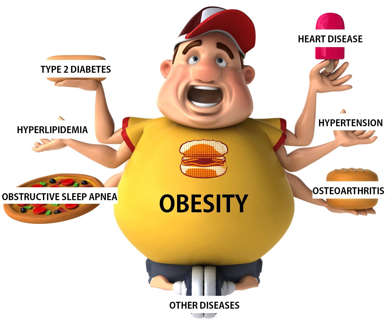 Obesity Is A Disease Akshay Obesity Is A Disease Akshay
