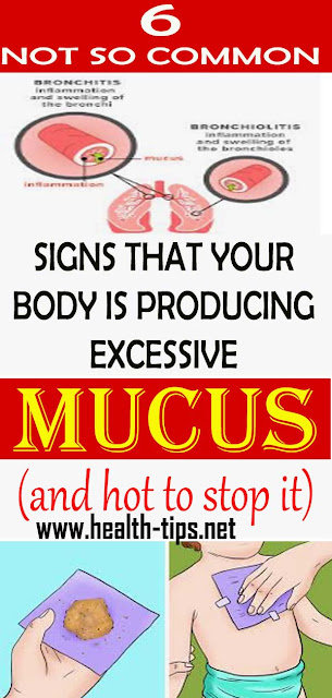 6 Signs Your Body Is Producing Excessive Mucus And How To Stop It