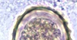 Rahmi Safitri Z0ne"_: Telur Ascaris Lumbricoides (Cacing Gelang)