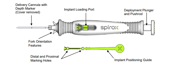 Burun Kanatlarının Ameliyat Dışı Desteklenmesi İçin "Spirox Latera ...