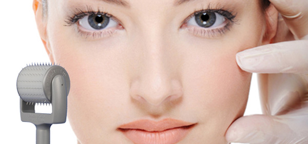 skinsolutionblog: Derma Rollers For Acne Scar Treatment