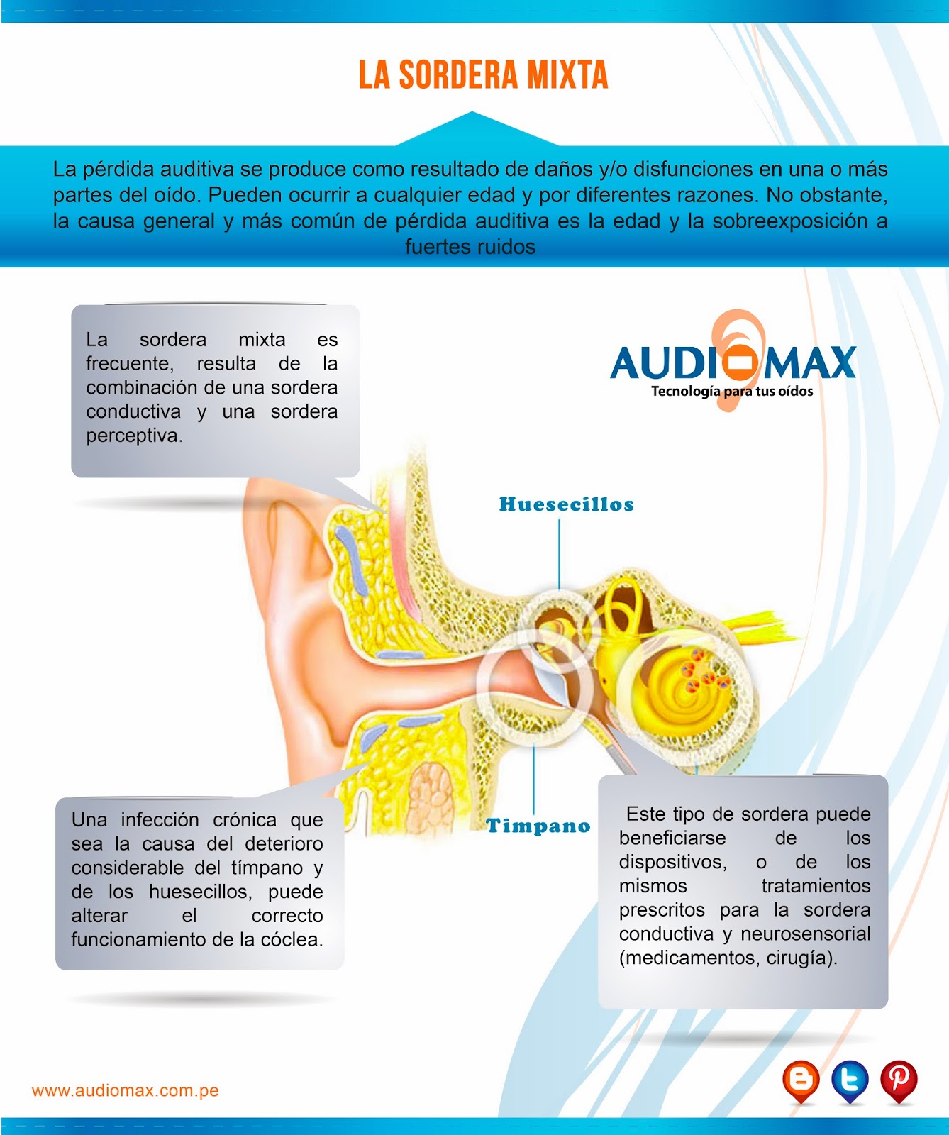 Audiomax: La Sordera Mixta