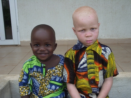 Bienvenu sur le site officiel de l'Ong "VALEUR ALBINOS": Les Albinos ...