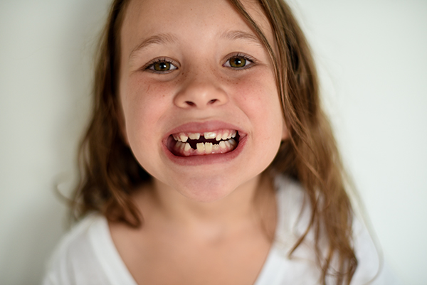 cahnicles: Big Girl Teeth