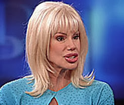 Bree Walker Plastic Surgery Before and After Lips and Facelift Photos ...