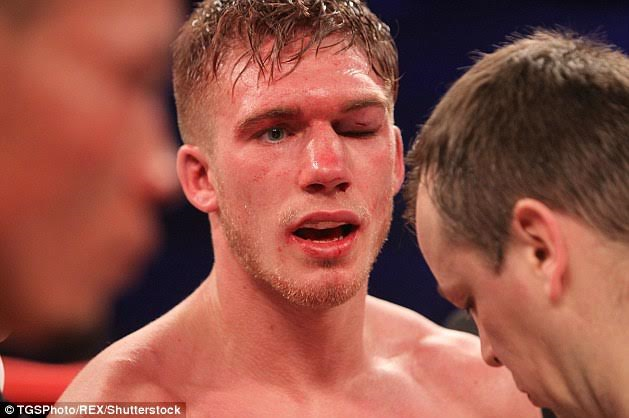 Photos: Why didn't the referee stop the fight? Boxer in coma after ...